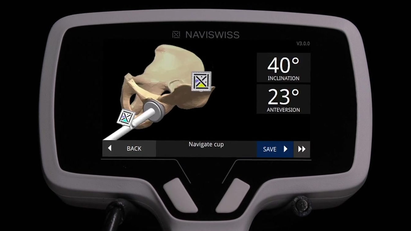 Navigation & Robotik | Sevika Medical | Schweiz | Distribution